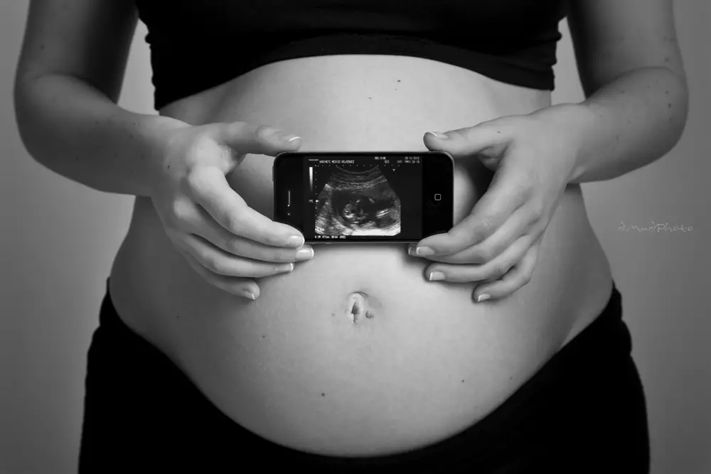 Etapa prenatal: Todo lo que una futura mamá debe saber Etapa prenatal: Todo lo que una futura mamá debe saber