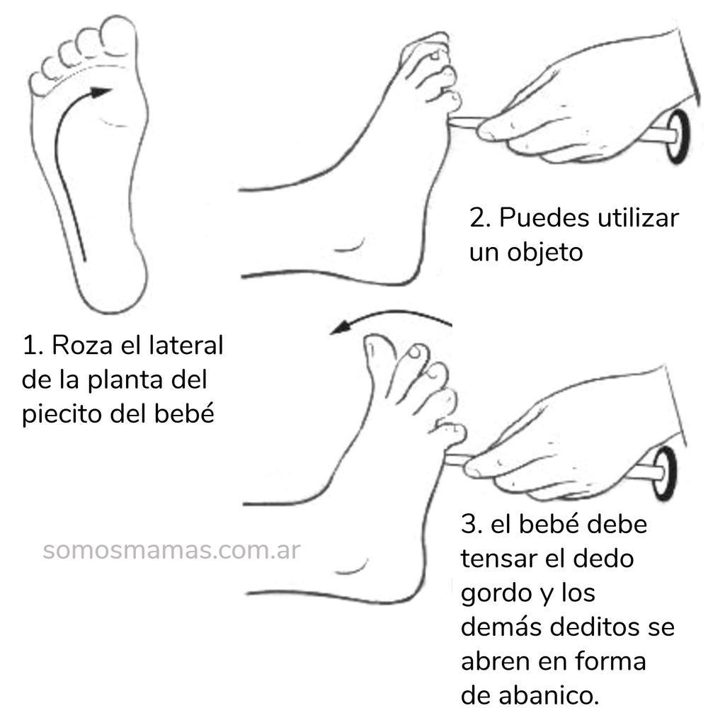 Reflexo De Babinski Em Bebê - LIBRAIN