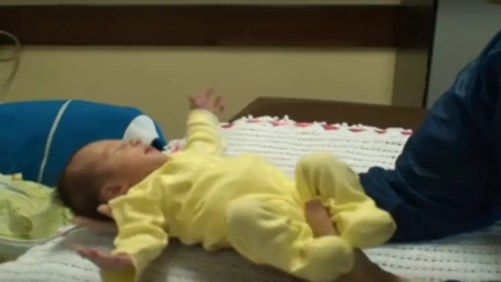 Test del Reflejo de Moro: Detecta a tiempo disfunciones neurológicas en ...