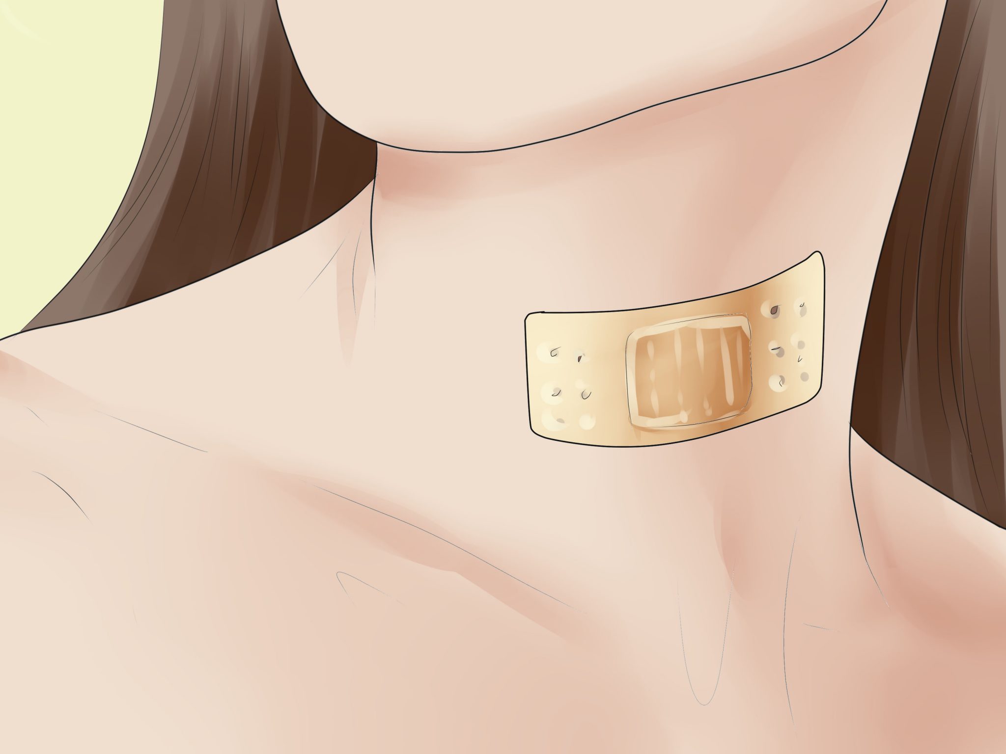 ¿Cómo quitar un chupetón? Trucos y remedios caseros para ocultarlo por ...