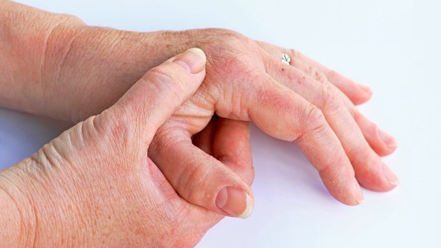 Resequedad en las manos: ¡Tips y cuidados para combatirla!