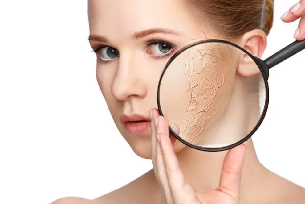 ¿Por qué se reseca la piel? ¡7 Factores por las que tu piel esta seca!