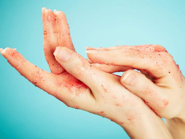¿Qué es exfoliar? Una técnica para tener un cutis perfecto