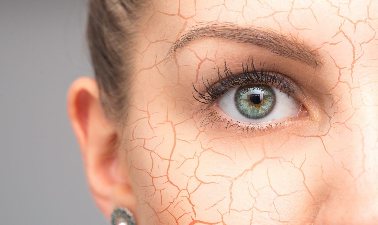 Piel deshidratada ¡Causas, consecuencias, tips y remedios para tratarla!